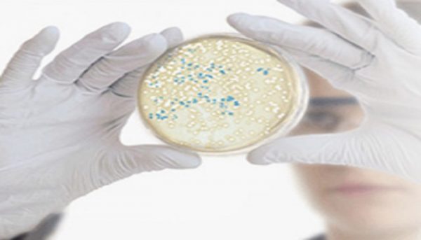 Bacterial transformation and selection – Science of Healthy